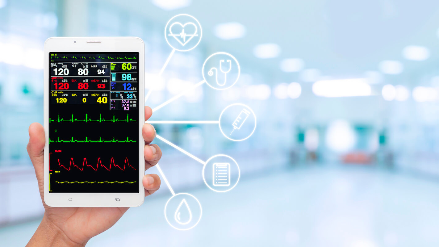 How to Implement RPM Systems